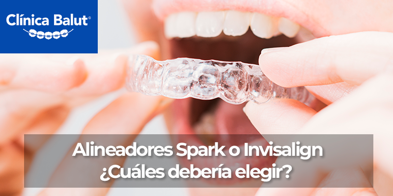 Alineadores Spark o Invisalign ¿Cuáles debería elegir?